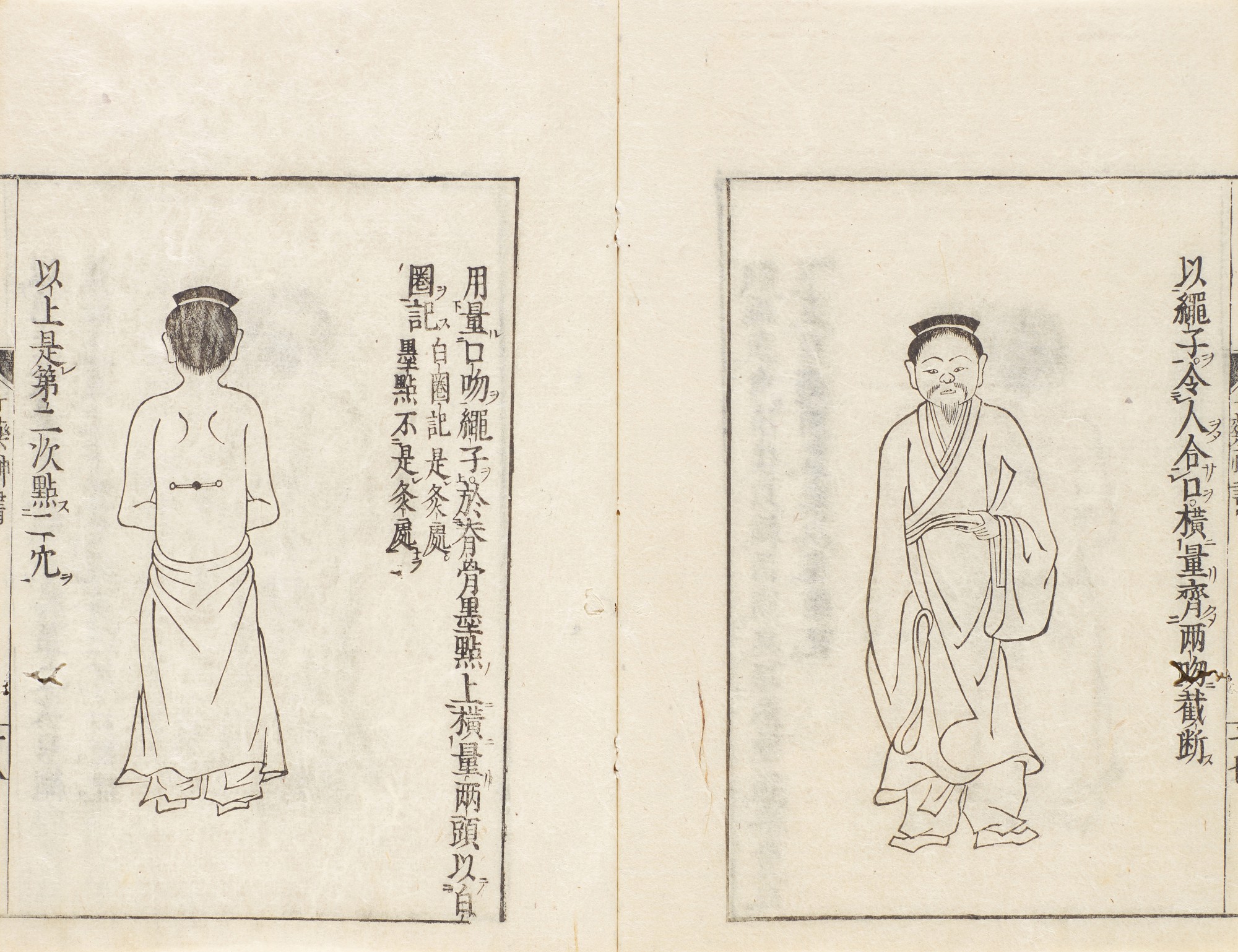 Anonymous | Divine Work on Ten Medicines (Juyaku shinsho) | Edo period ...