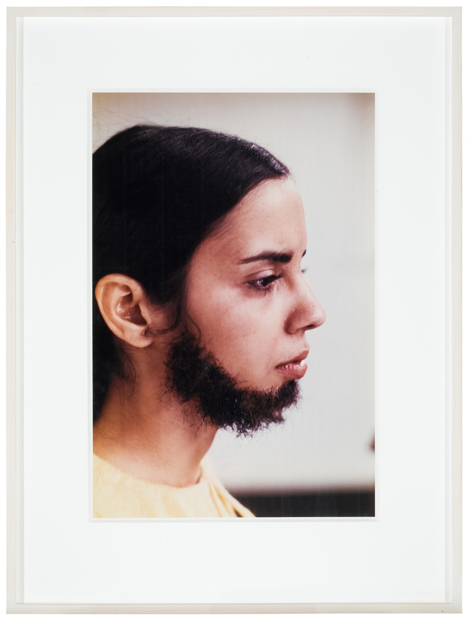 'Untitled (Facial Hair Transplants) (7 works)', 1972 | (Women) Artists ...