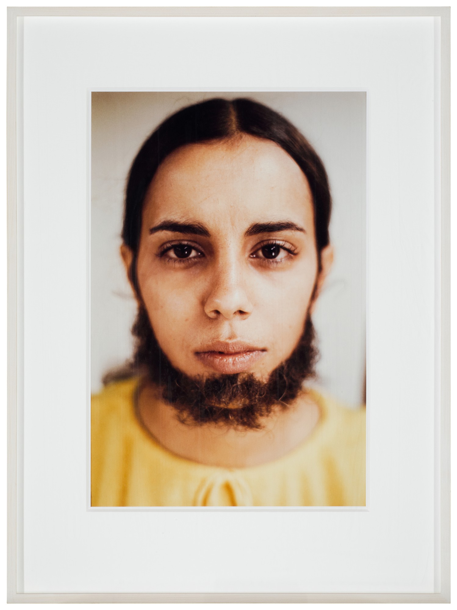 'Untitled (Facial Hair Transplants) (7 works)', 1972 | (Women) Artists ...